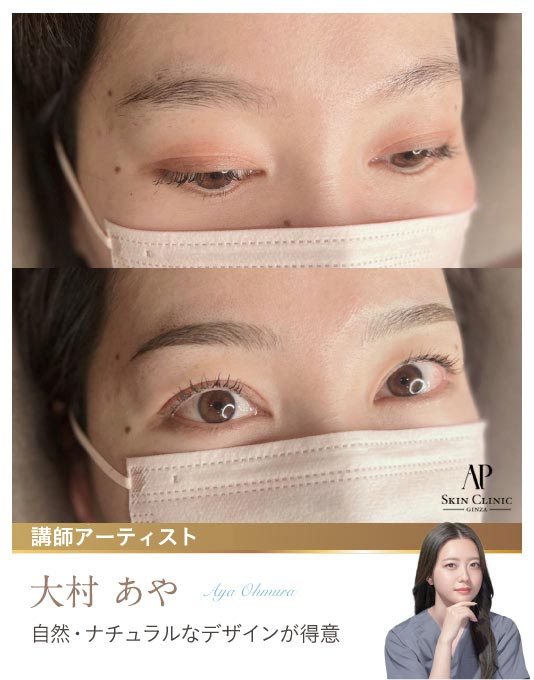 APスキンクリンニック銀座の医療アートメイク