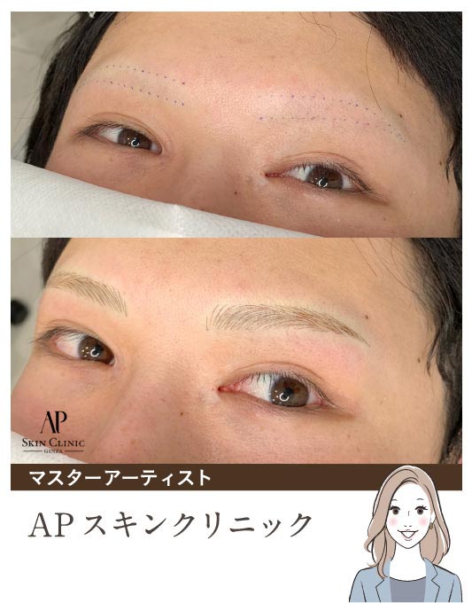 APスキンクリンニック銀座の医療アートメイク